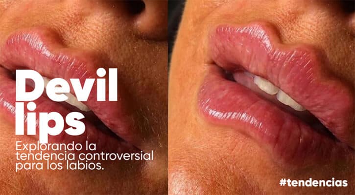 Los "Devil Lips" Explorando la Tendencia Controversial de la ...